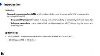 Pulmonary Embolism & Deep Vein Thrombosis - Handout.pdf