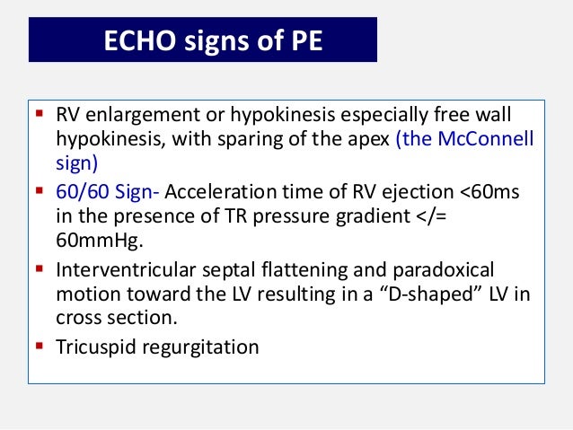 Pulmonary Embolism- Diagnosis by Dr.Tinku Joseph