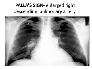 Pallas Sign