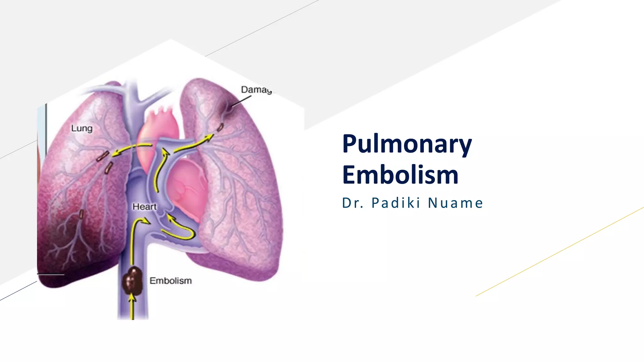 Pulmonary Embolism FINAL 2.pptx