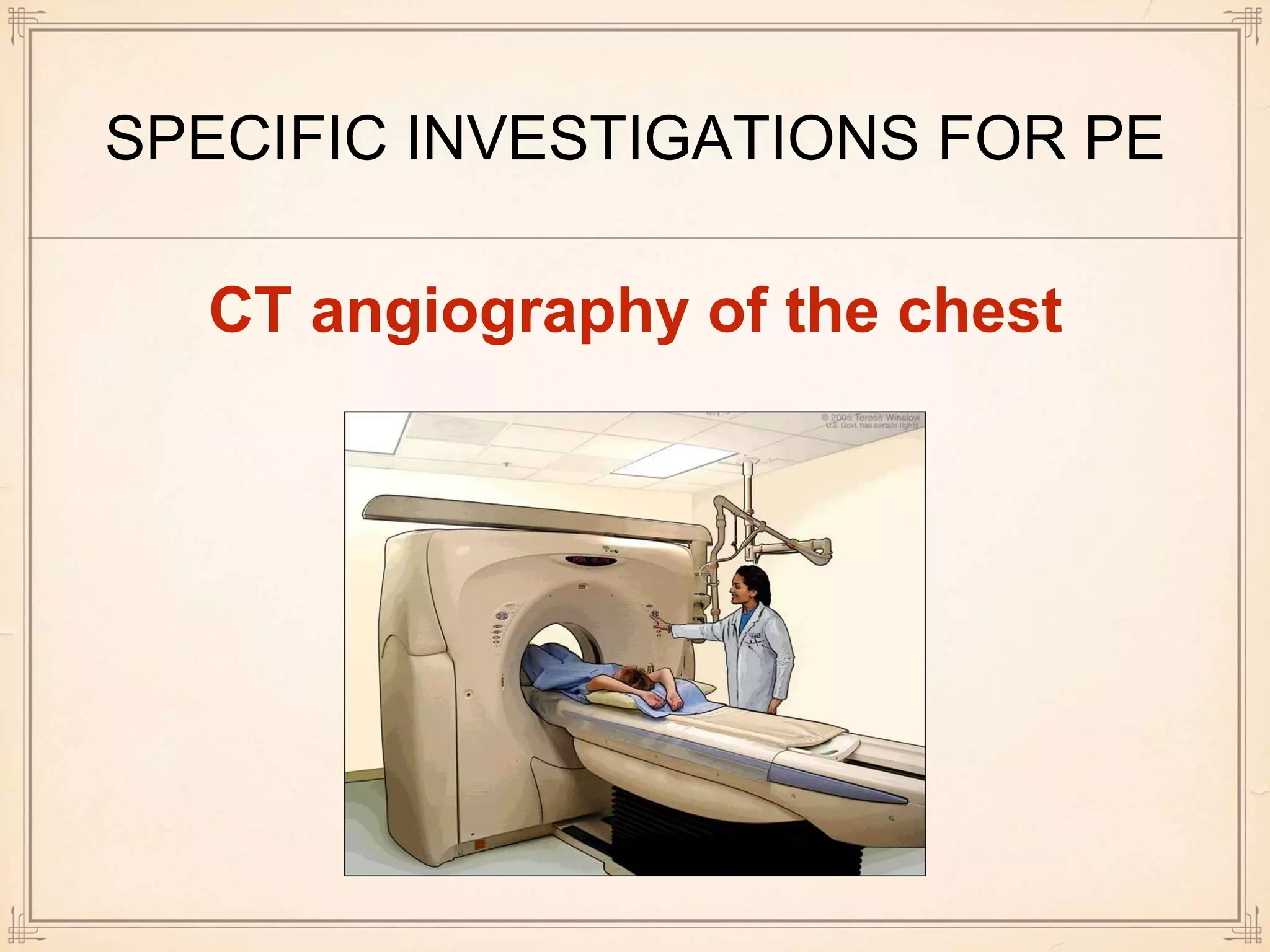 Pulmonary embolism investigations | PPTX