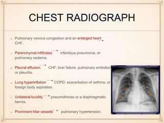 Pulmonary embolism investigations | PPT