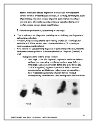 Pulmonary embolism ms | DOCX