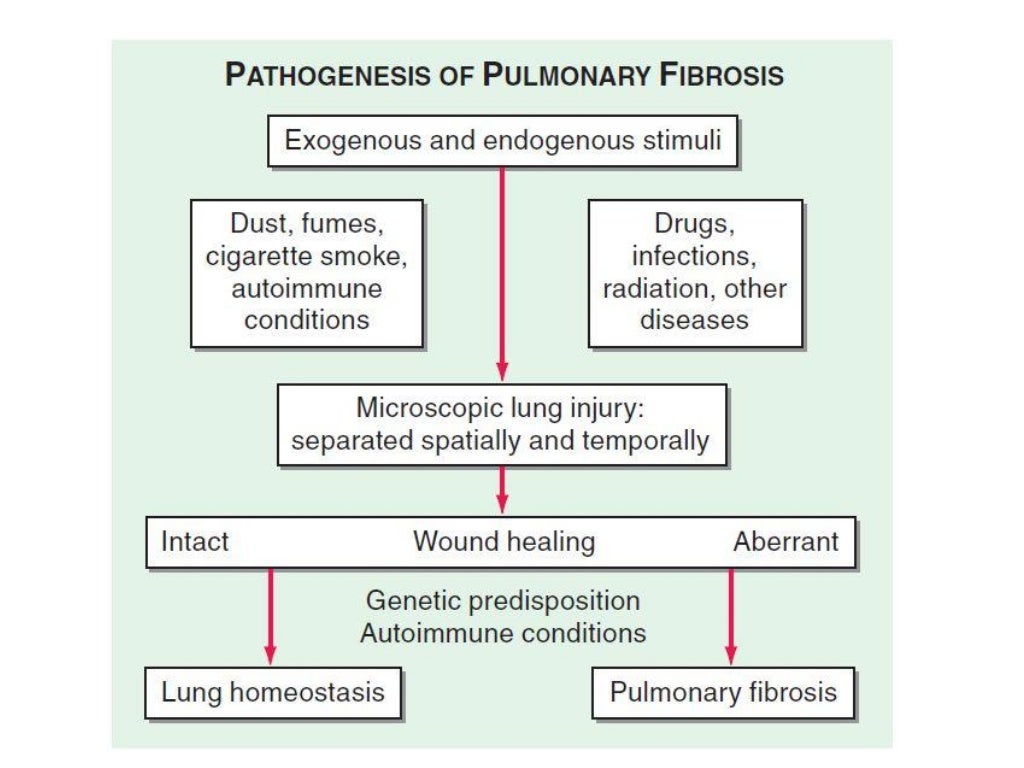 Pulmonary fibrosis