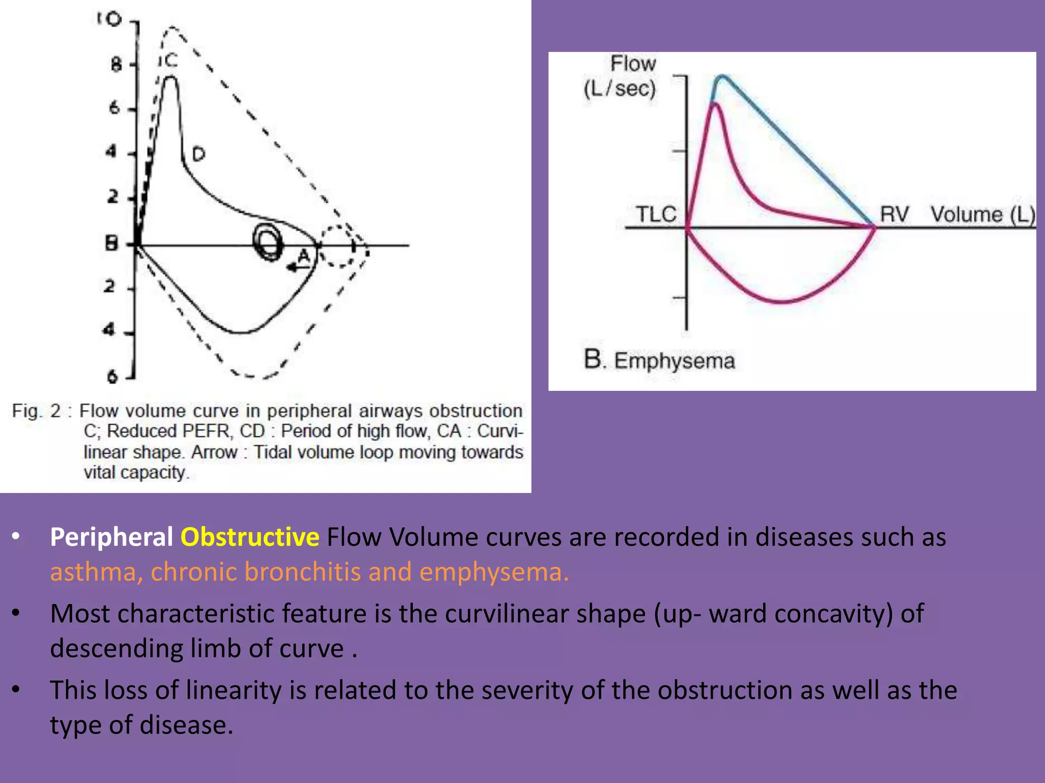 Pulmonary Flow Volume Loops.. Dr.Padmesh | PPTX