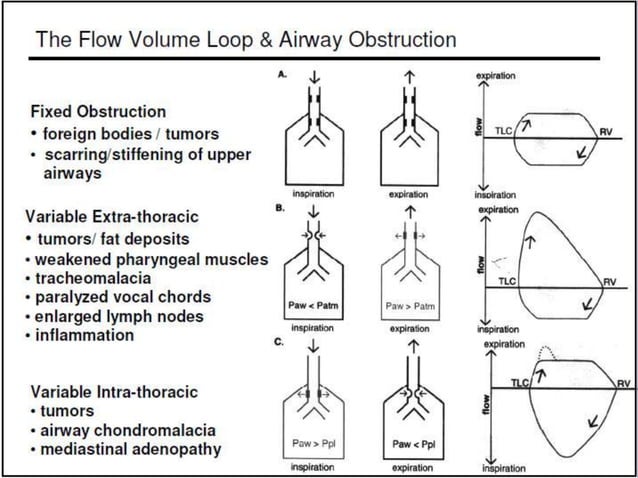 Pulmonary Flow Volume Loops.. Dr.Padmesh | PPTX | Lung and Respiratory ...