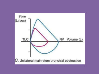 Pulmonary Flow Volume Loops.. Dr.Padmesh | PPTX