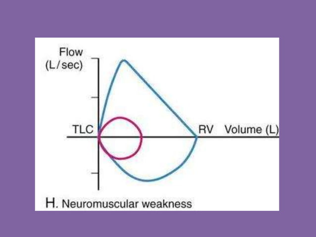 Pulmonary Flow Volume Loops.. Dr.Padmesh | PPTX | Lung and Respiratory ...
