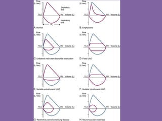 Pulmonary Flow Volume Loops.. Dr.Padmesh | PPTX