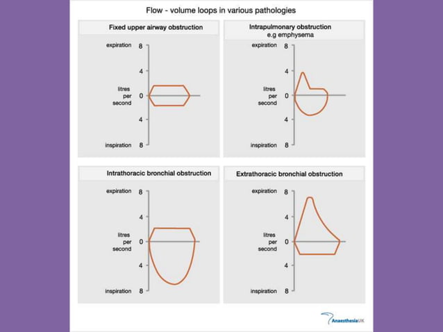 Pulmonary Flow Volume Loops.. Dr.Padmesh | PPTX | Lung and Respiratory ...