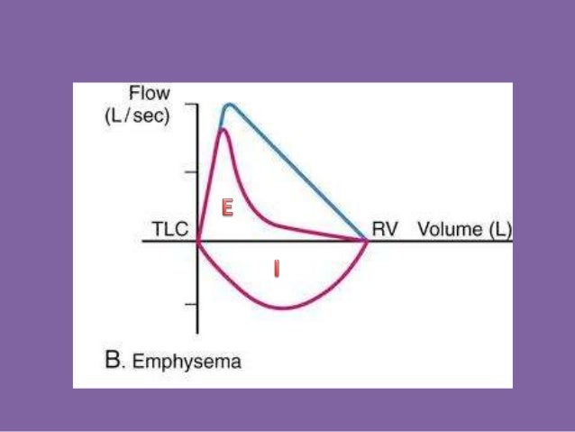 Pulmonary Flow Volume Loops.. Dr.Padmesh