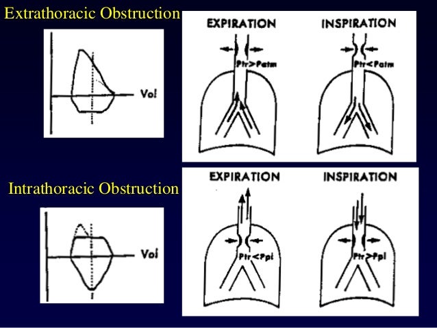 Pulmonary function exam