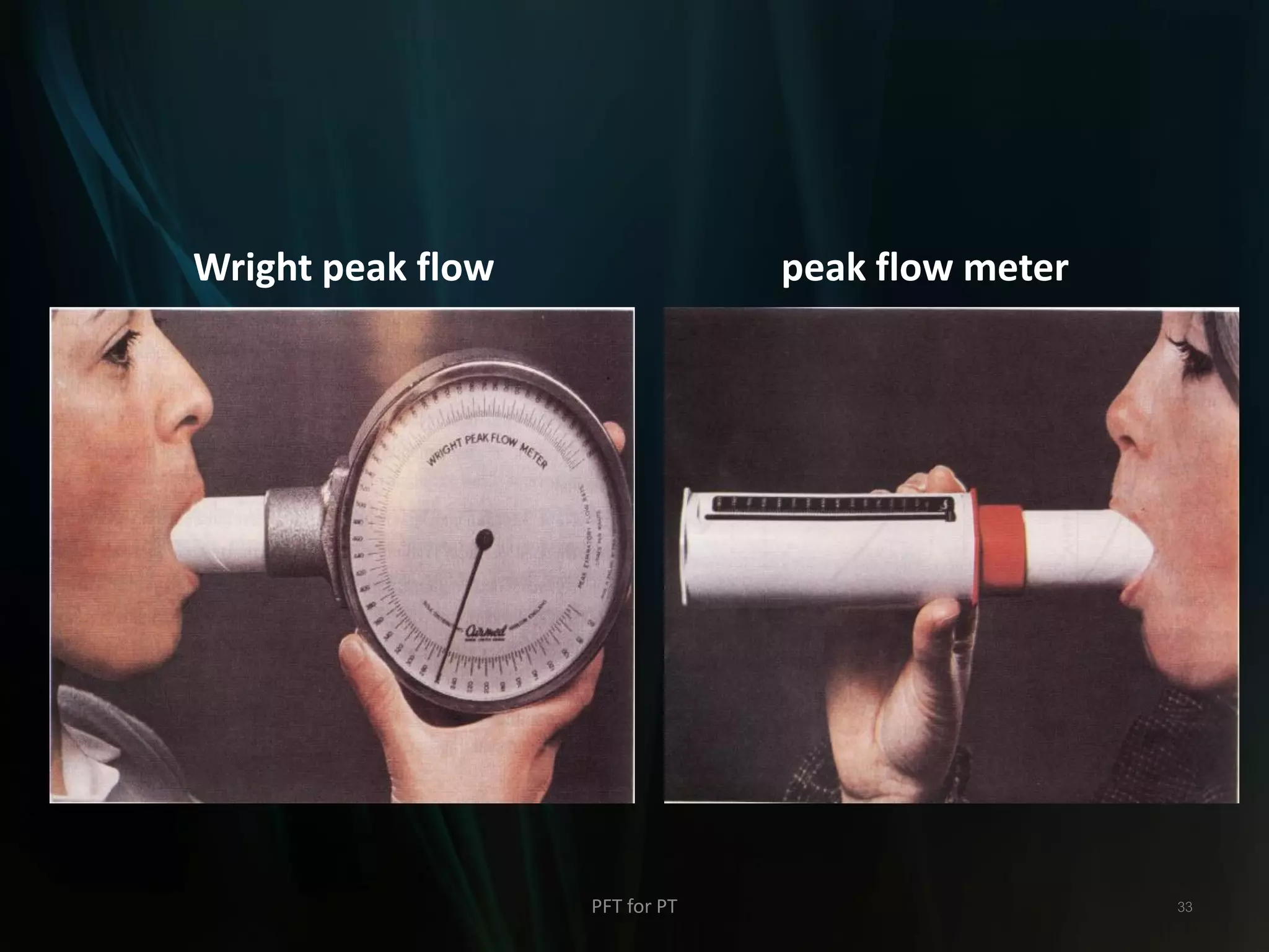 Pulmonary function test | PDF