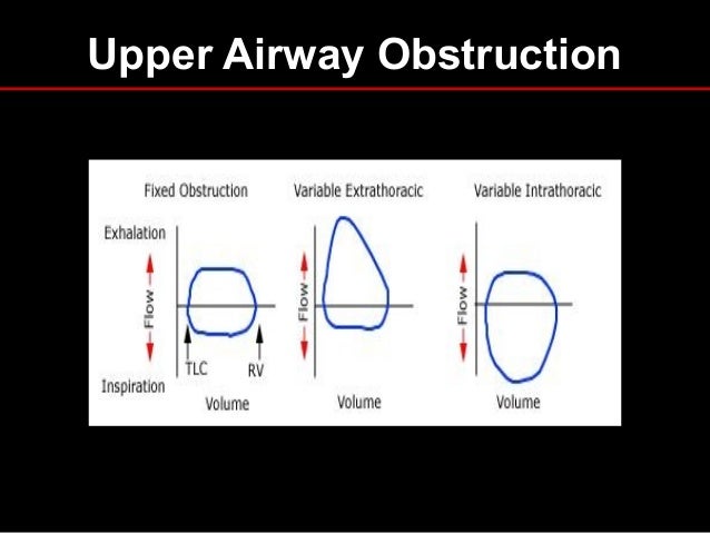 Pulmonary Function Testing