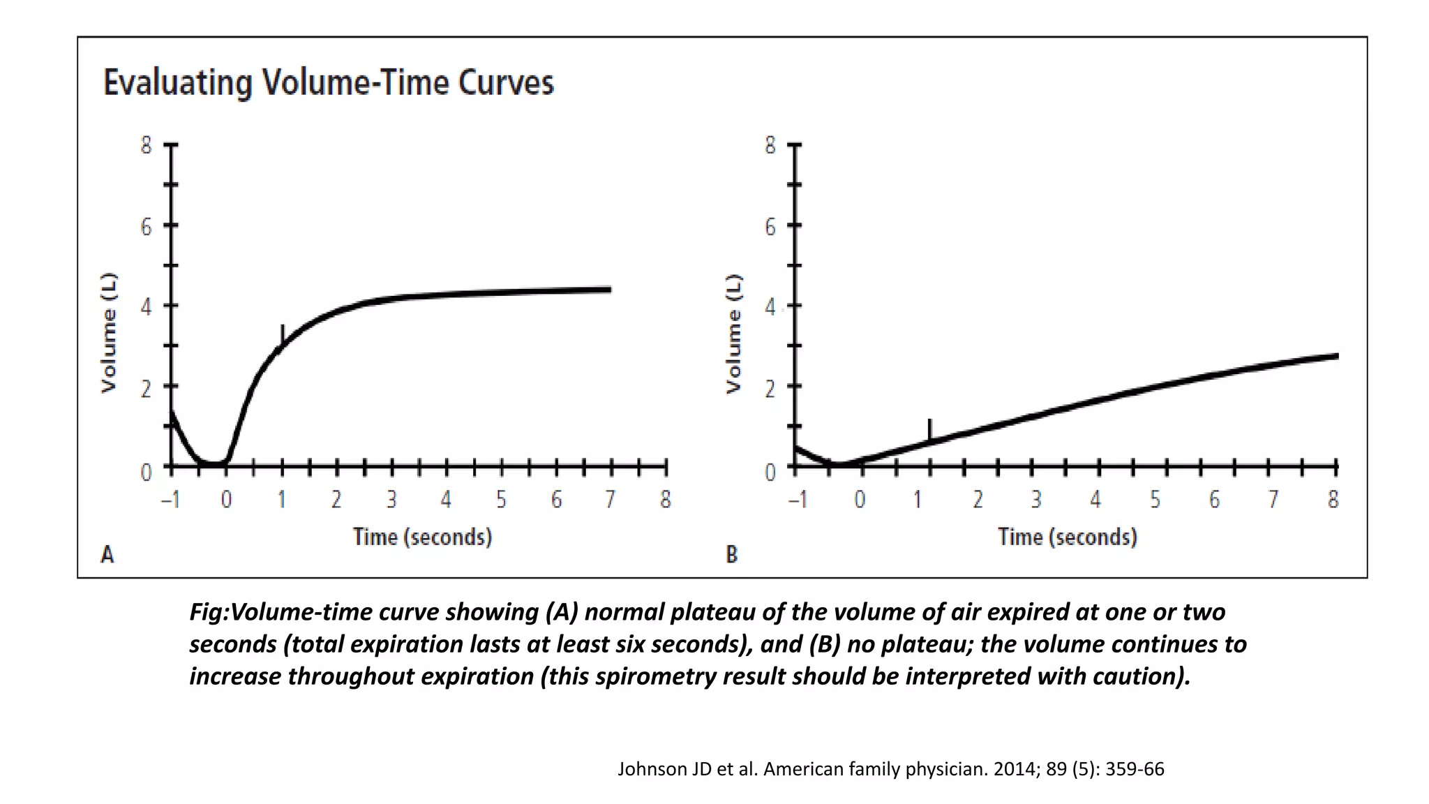 PULMONARY FUNCTION TEST(PFT).pptx