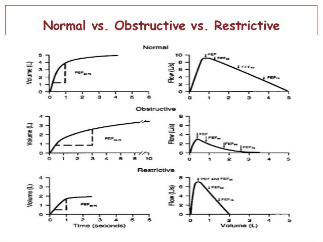Pulmonary function tests