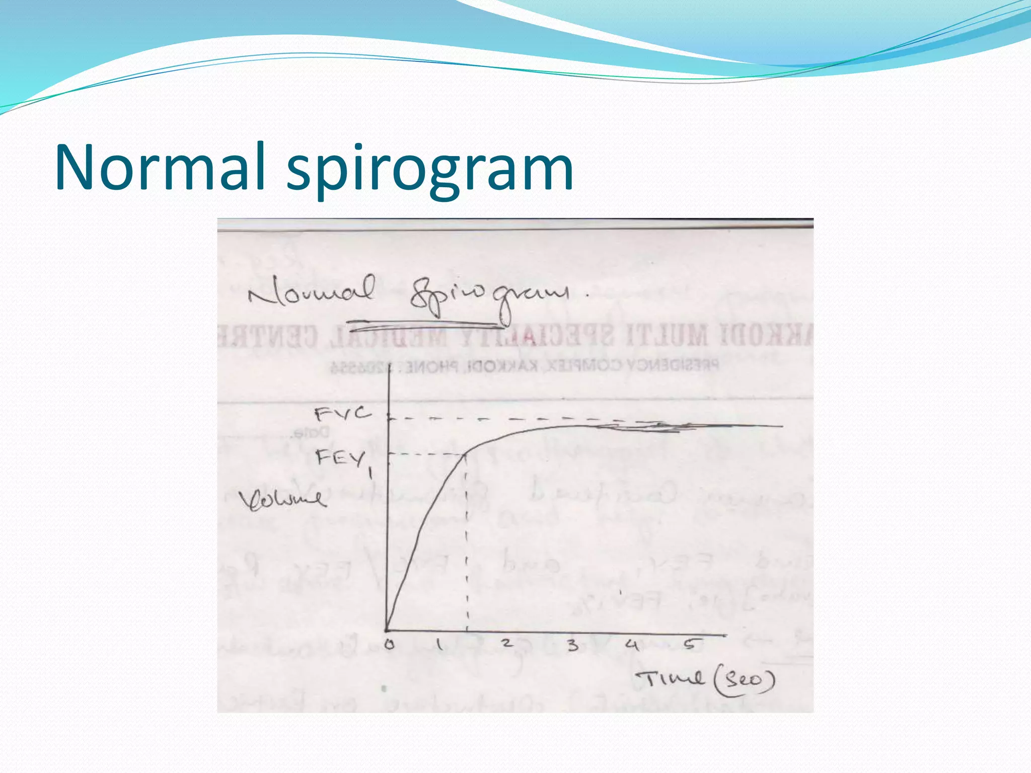 Pulmonary function tests | PPTX