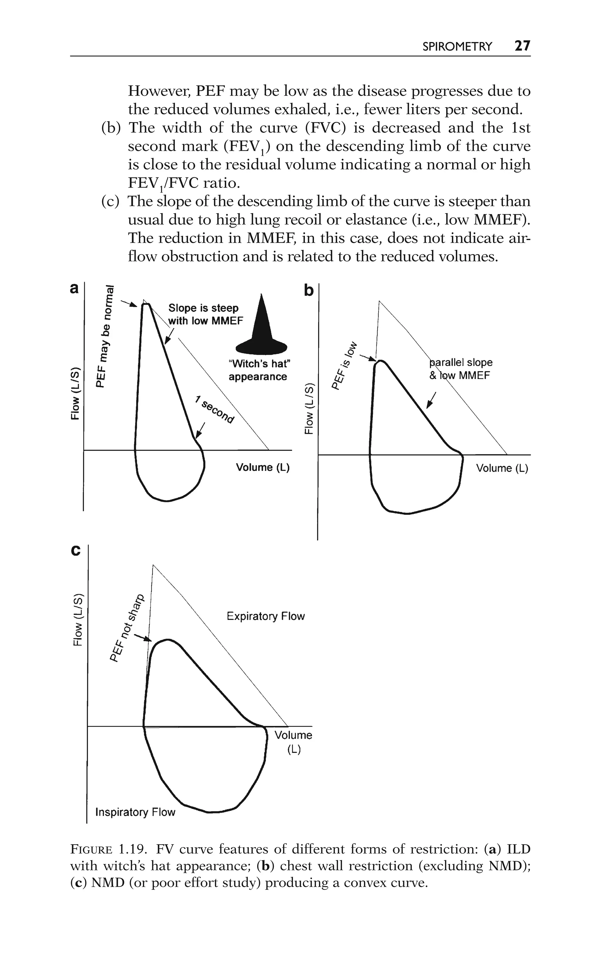 Pulmonary function tests_in_clinical_practice | PDF