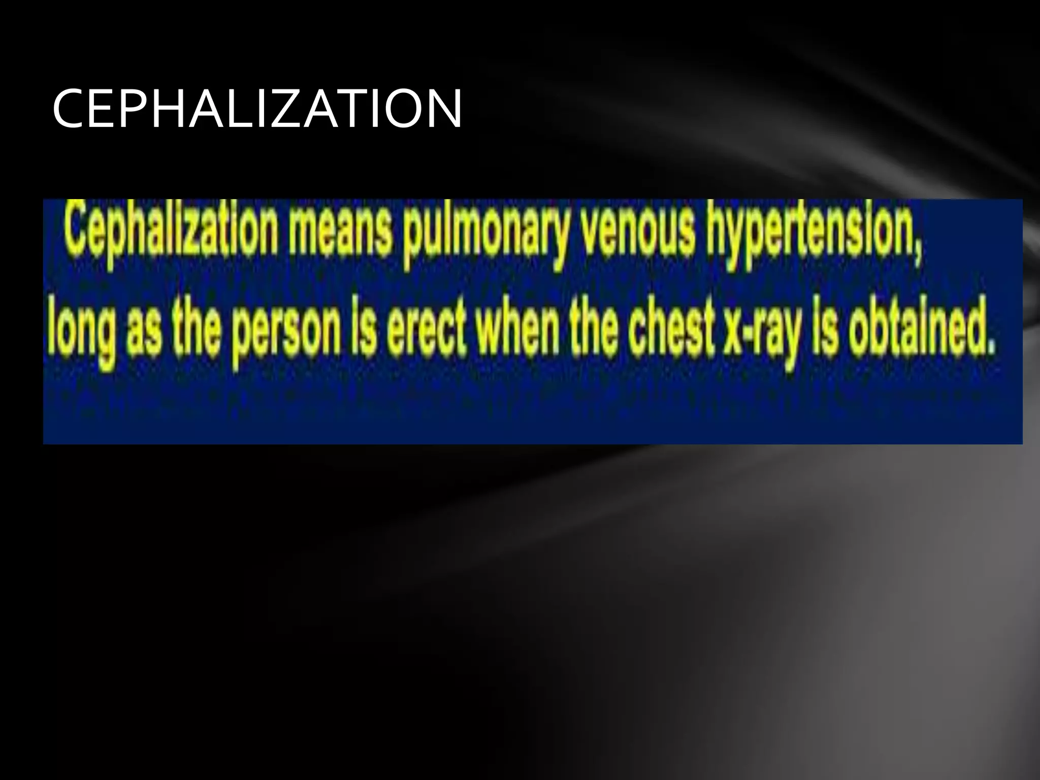 Pulmonary hypertension | PPTX