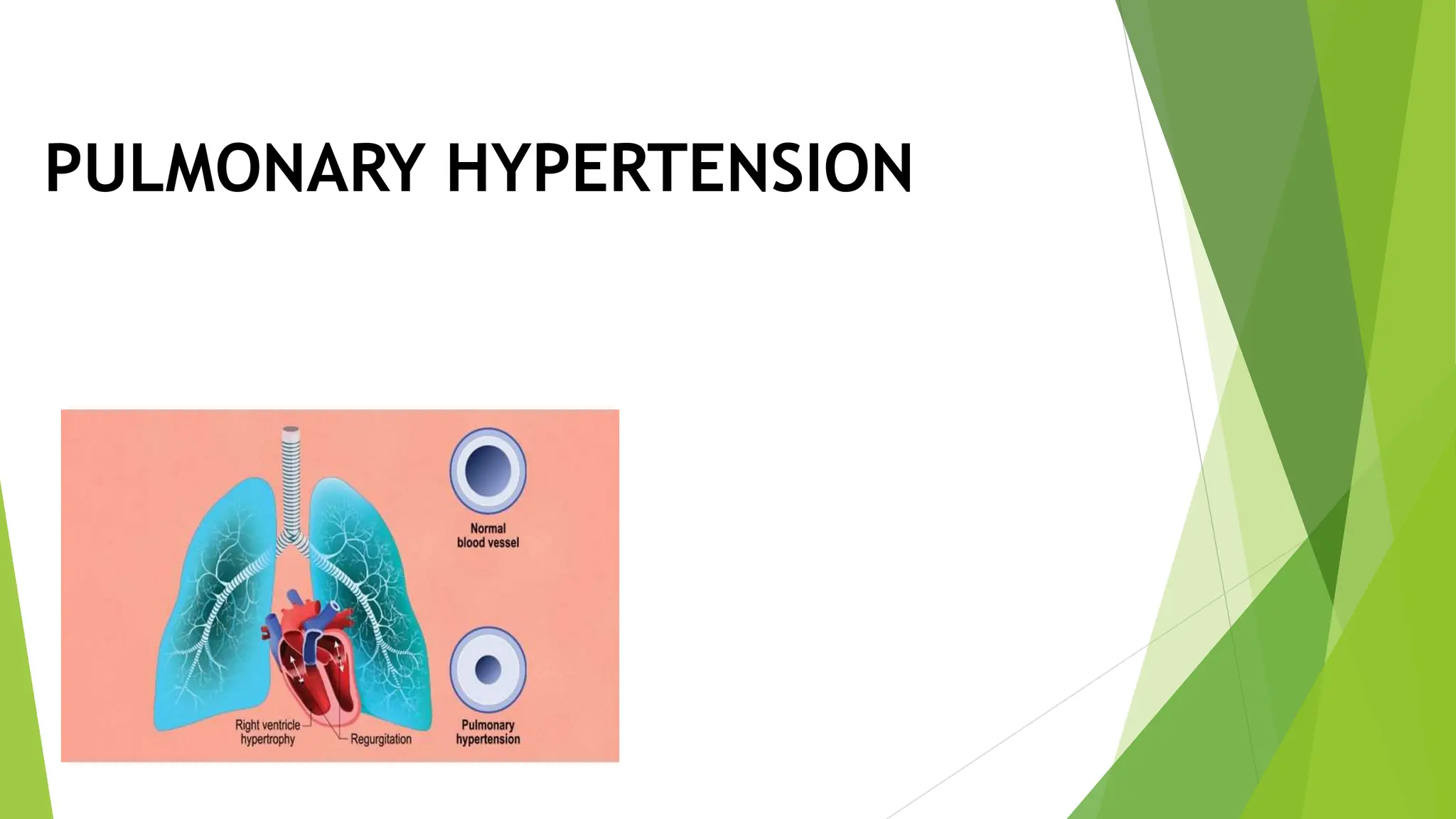 CLINICAL PROFILE AND TREATMENT OF PULMONARY HYPERTENSION | PPTX