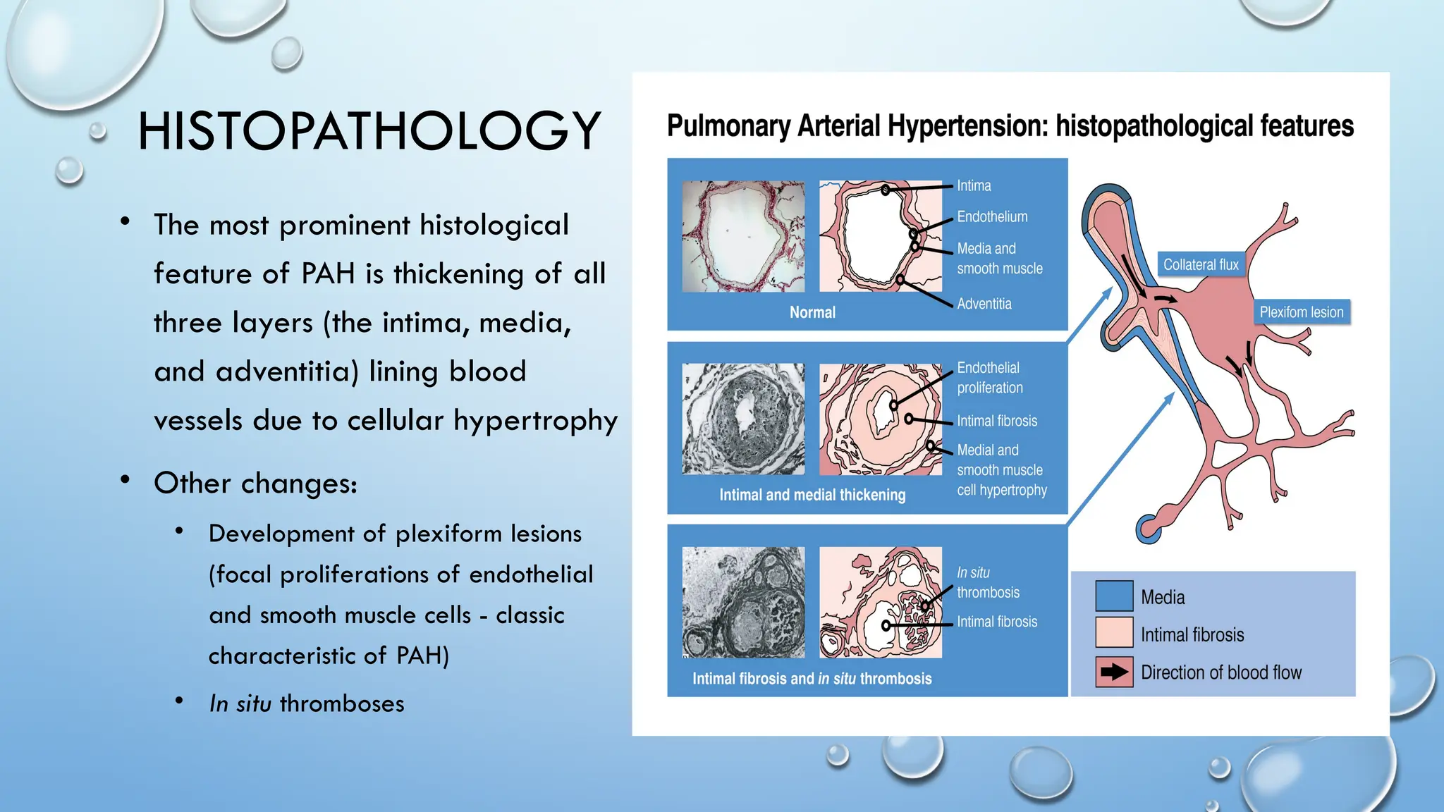 "Pulmonary Hypertension: Pathophysiology, Diagnosis and Emergency ...