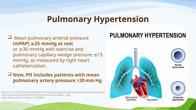 Approach to Pulmonary Hypertension Diagnosis & Management | PPT