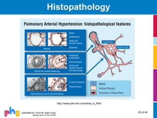 Pulmonary Hypertension in Infants and Children | PDF