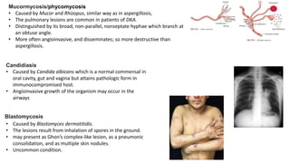 Pulmonary inections.pptx