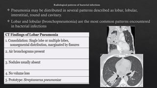 ROLE OF RADIOLOGY IN PULMONARY INFECTIONS | PPTX