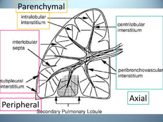 Lung Parenchyma Anatomy