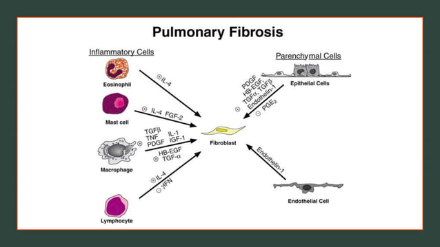 Pulmonary interstitium | PPTX | Lung and Respiratory Health | Diseases ...