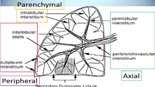 Pulmonary interstitium | PPTX | Lung and Respiratory Health | Diseases ...