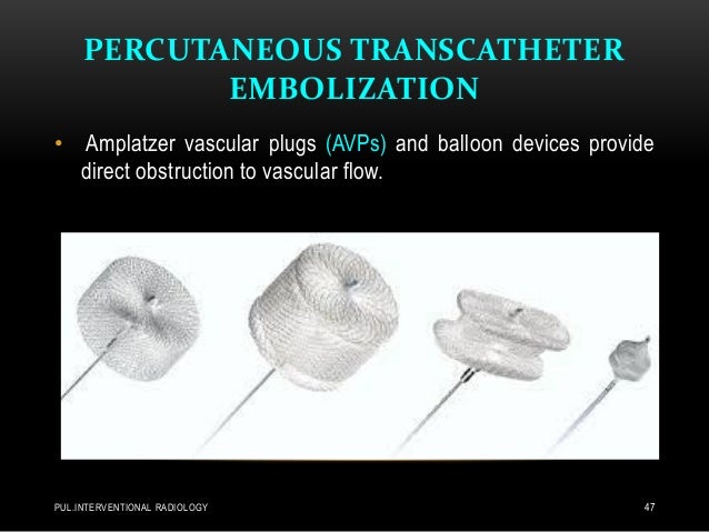 Pulmonary interventional radiology techniques
