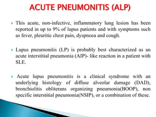 Pulmonary manifestation of systemic lupus | PPTX