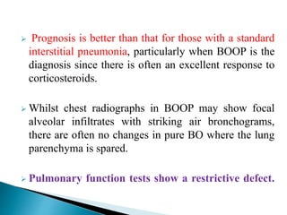 Pulmonary manifestation of systemic lupus | PPTX