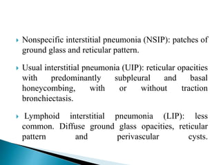Pulmonary manifestation of systemic lupus | PPTX