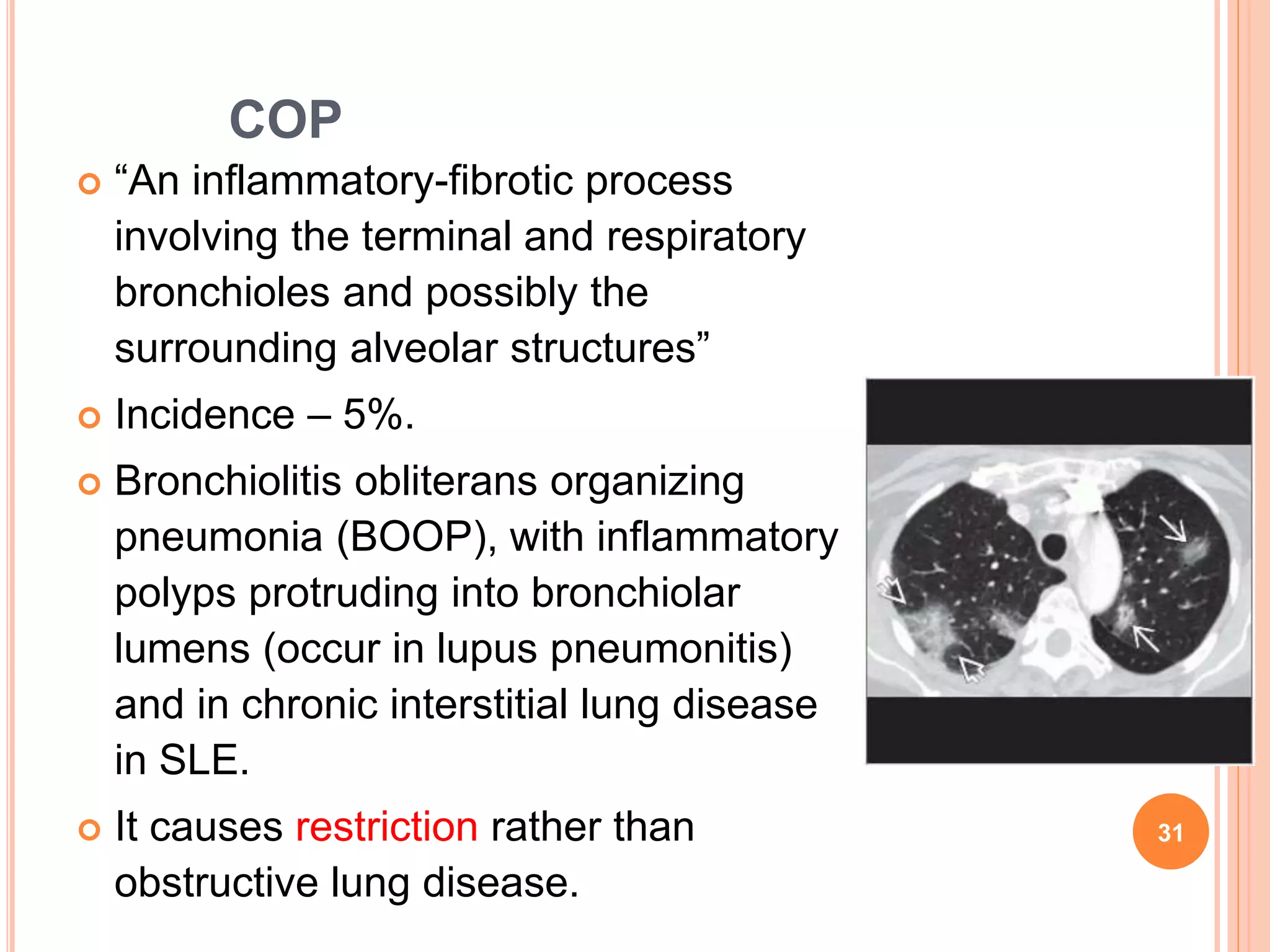 Pulmonary manifestations of collagen vascular diseases | PPTX