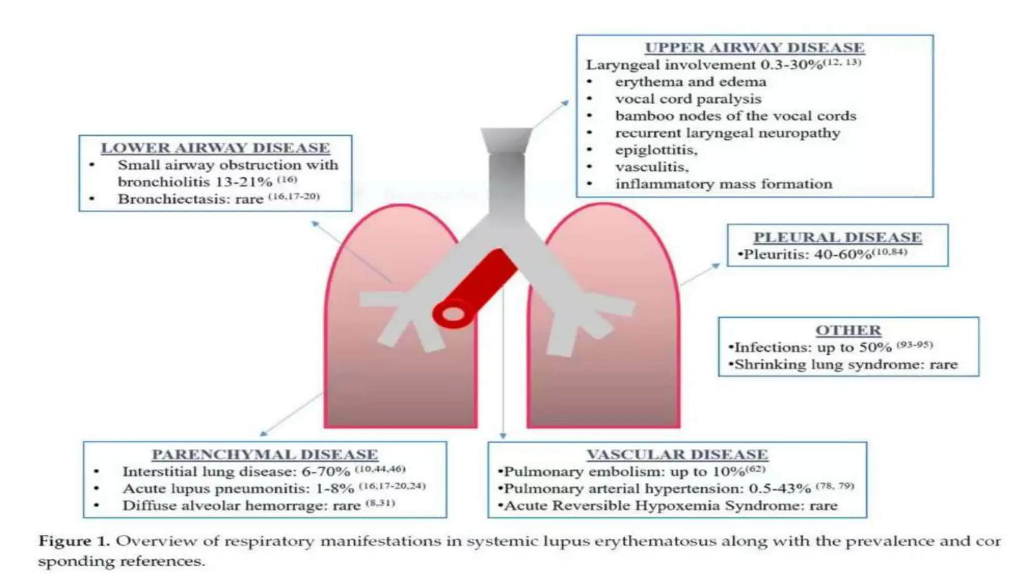 Pulmonary Manifestations of SLE.pptxpt | PPT | Lung and Respiratory ...