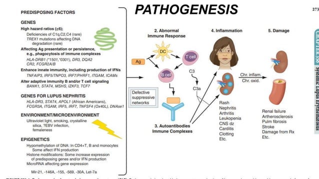Pulmonary Manifestations of SLE.pptxpt | PPT | Lung and Respiratory ...