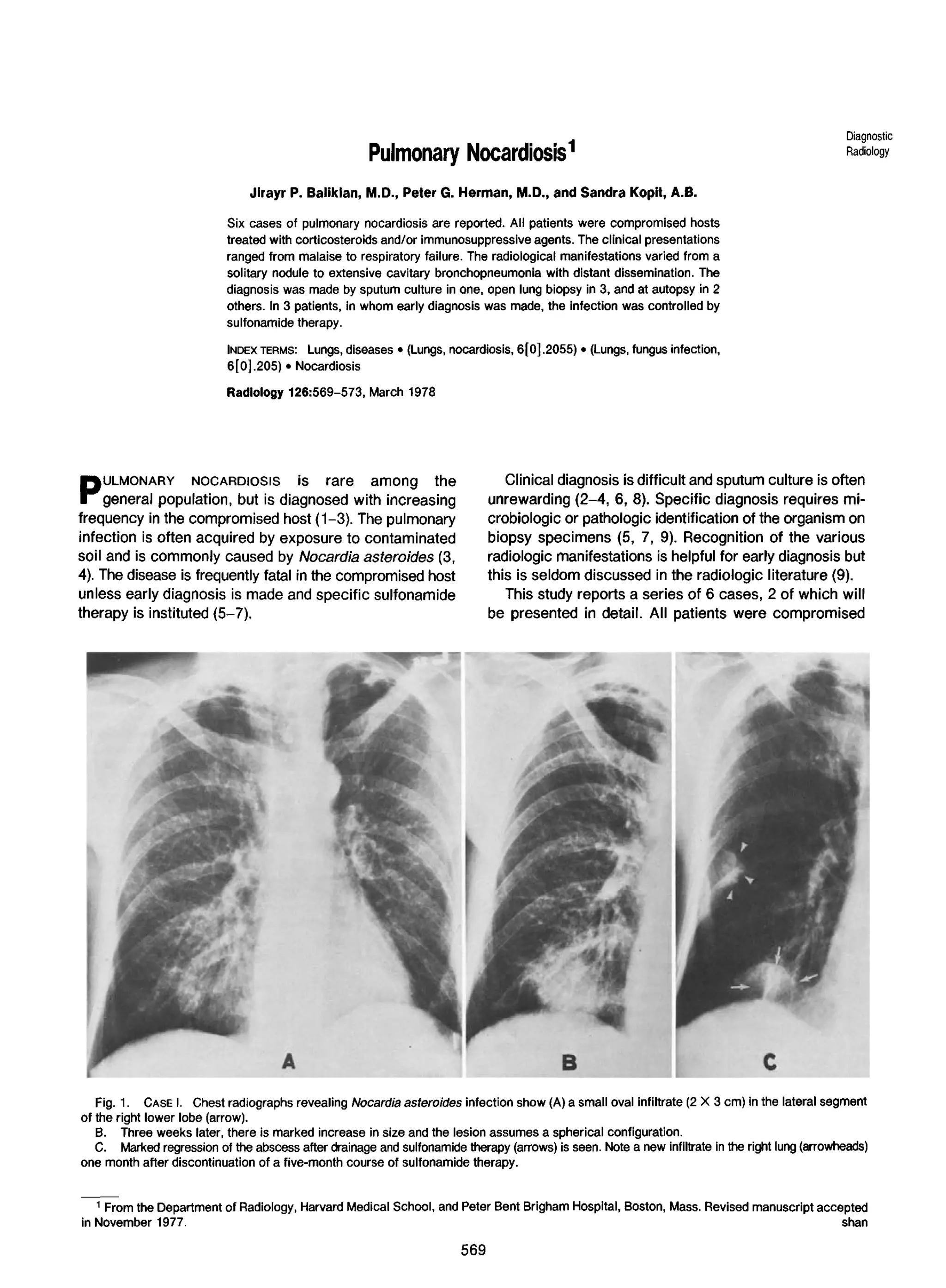 Pulmonary nocardiosis | PDF