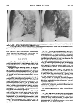 Pulmonary nocardiosis | PDF