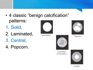 Pulmonary Nodule.pptx
