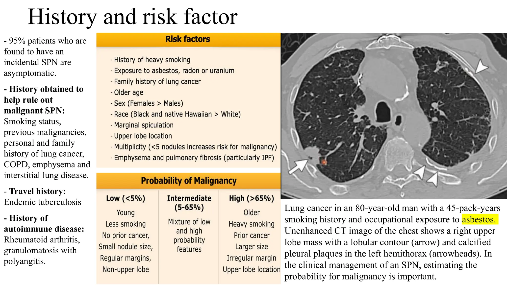Approach to imaging of Solitary pulmonary nodule .pptx