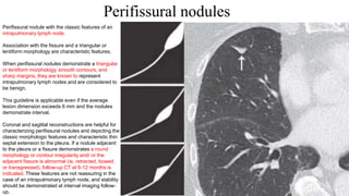 Approach to imaging of Solitary pulmonary nodule .pptx