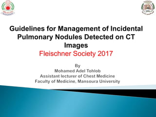 Pulmonary nodules | PPTX