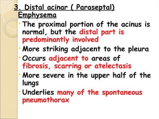 Pulmonary Pathology anatomy pneumonia lung ca | PPT