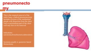 Pulmonary Resection by Dr hafeez mukhtar | PPTX
