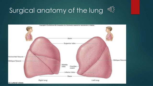 Pulmonary resection