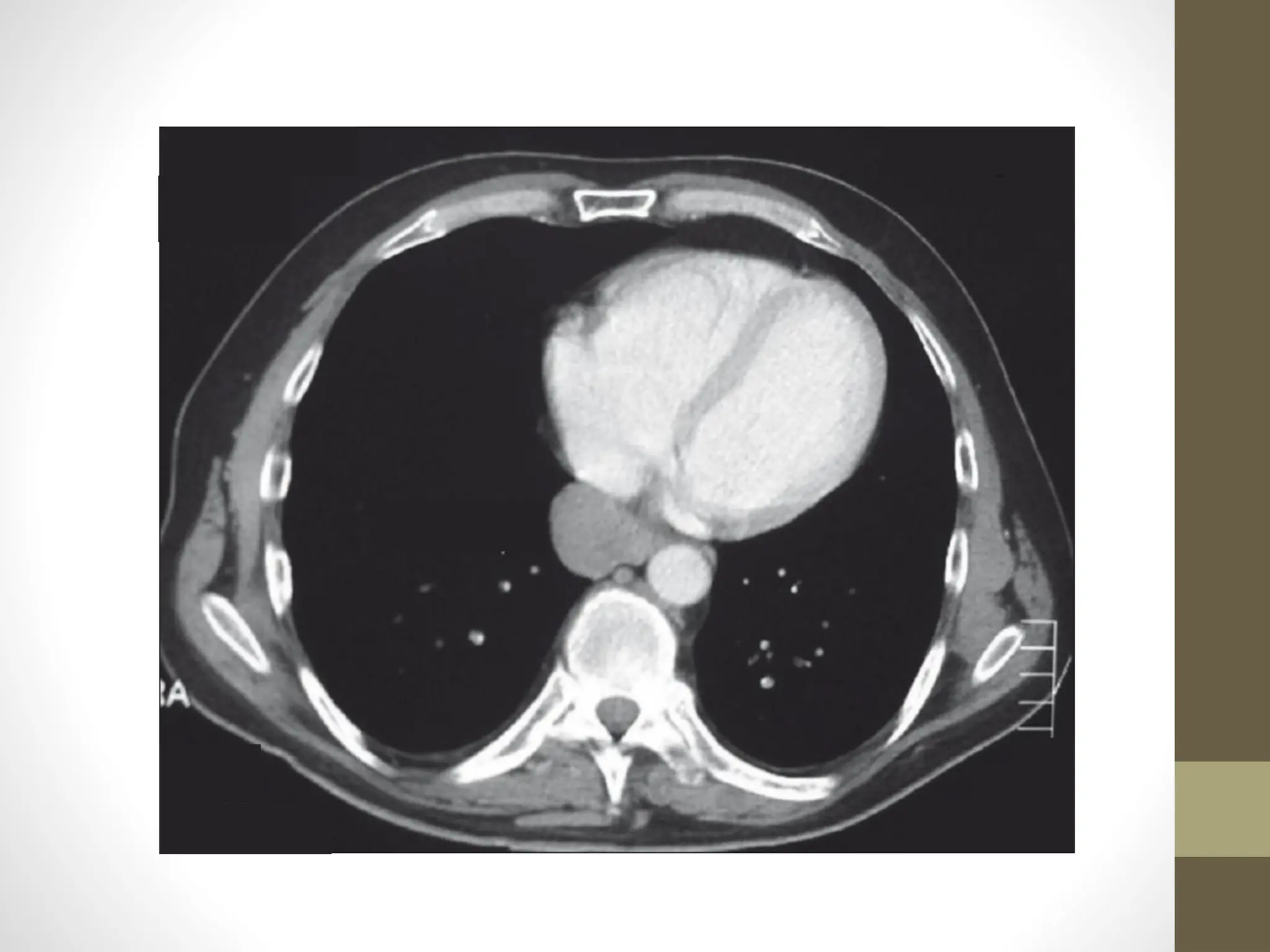 PulmonarySldes [MedicalBooksVN.com] (1).pptx