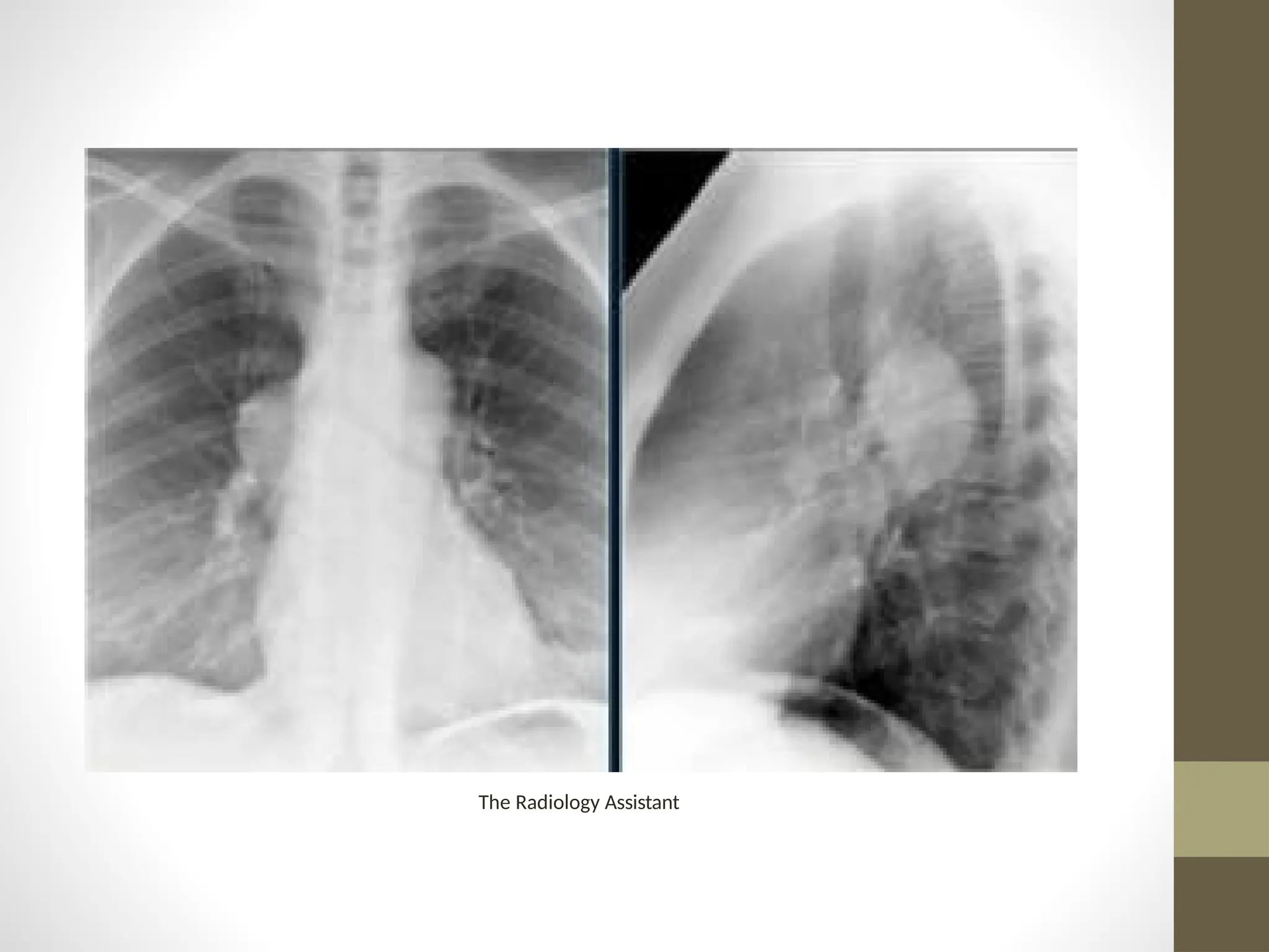 PulmonarySldes [MedicalBooksVN.com] (1).pptx